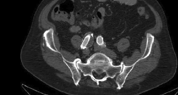 exames – Urologia-MarioPereiraLourenco